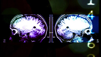 Policy Innovations Digital Magazine (2006-2016): Briefings: Brain Scan ...